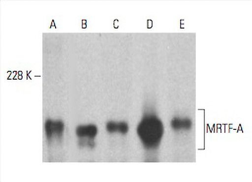 MRTF-A/MKL1 Antibody (G-8) | SCBT - Santa Cruz Biotechnology