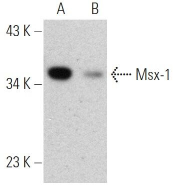 Msx-1 Antibody (5D11) | SCBT - Santa Cruz Biotechnology
