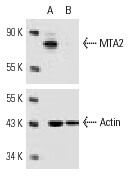MTA2 siRNA (h), shRNA and Lentiviral Particle Gene Silencers | SCBT ...