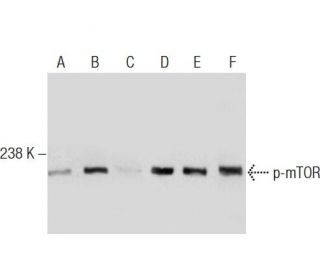 mTOR Antibody (30) - Western Blotting - Image 383030