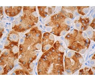 Mucin 1 Antibody (VU4H5) - Immunohistochemistry - Image 388768