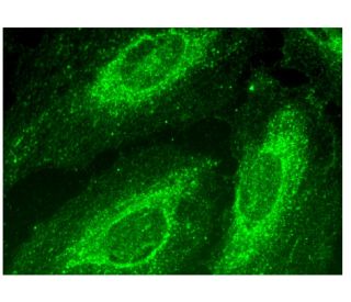 Anti-Mucin 12/MUC12 Antibody (G-1) | SCBT - Santa Cruz Biotechnology