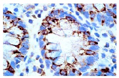 Mucin 2/MUC2 Antibody (Ccp58) | SCBT - Santa Cruz Biotechnology