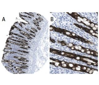 Mucin 2 Antibody (Ccp58) - Immunohistochemistry - Image 37942