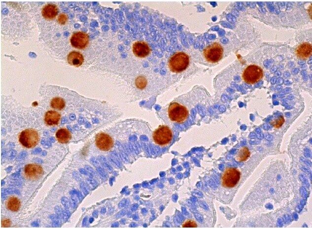Mucin 2/MUC2 Antibody (F-2) | SCBT - Santa Cruz Biotechnology