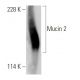 Mucin 2/MUC2 Antibody (F-2) | SCBT - Santa Cruz Biotechnology