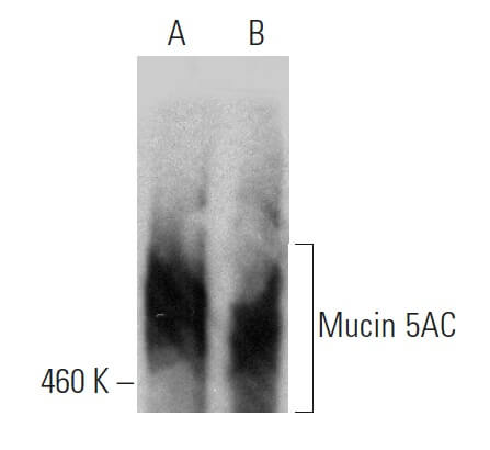 Anti-Mucin 5AC/MUC5AC Antibody (2Q445) | SCBT - Santa Cruz Biotechnology