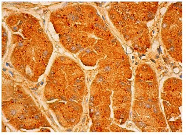 Mucin 5AC/MUC5AC抗体 (45M1) | SCBT - Santa Cruz Biotechnology