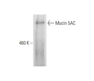 Anti-Mucin 5AC/MUC5AC Antibody (A-5) | SCBT - Santa Cruz Biotechnology