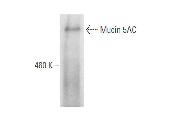 Anti-Mucin 5AC/MUC5AC Antibody (A-5) | SCBT - Santa Cruz Biotechnology