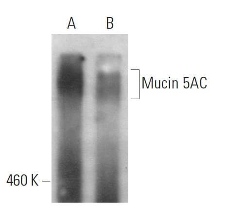 Mucin 5AC/MUC5AC抗体 (A-5) | SCBT - Santa Cruz Biotechnology