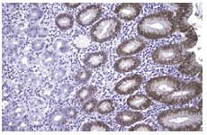 Mucin 5AC/MUC5AC Antibody (CLH2) | SCBT - Santa Cruz Biotechnology