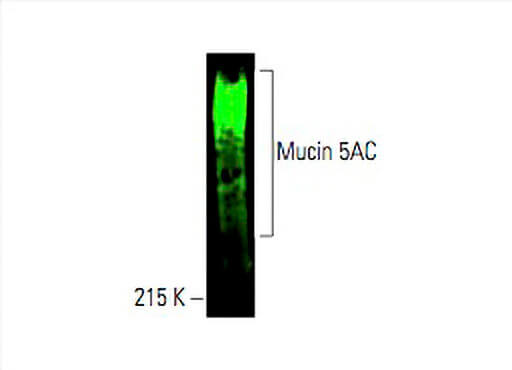 Anti-Mucin 5AC/MUC5AC Antibody (CLH2) | SCBT - Santa Cruz Biotechnology