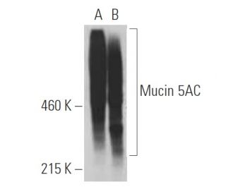 Mucin 5AC Antibody (CLH2) - Western Blotting - Image 394946