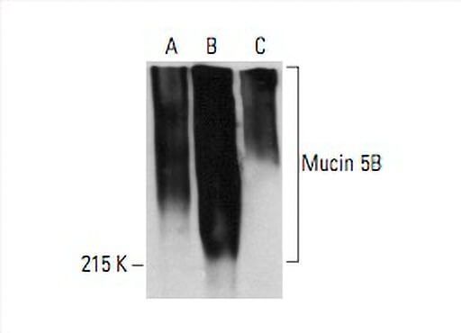 Mucin 5B/MUC5B抗体 (A-3) | SCBT - Santa Cruz Biotechnology