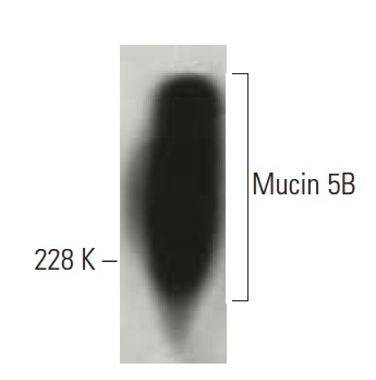 Anti-Mucin 5B/MUC5B Antibody (A-3) | SCBT - Santa Cruz Biotechnology
