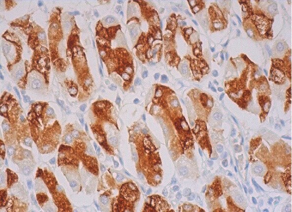 Anti-Mucin 6/MUC6 Antibody (CLH5) | SCBT - Santa Cruz Biotechnology