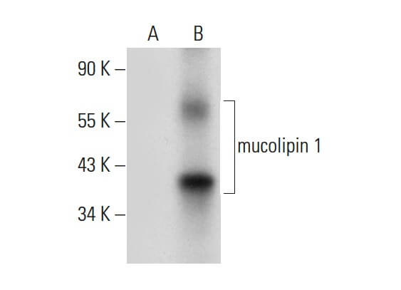 Anti-mucolipin 1 Antibody (F-10) | SCBT - Santa Cruz Biotechnology