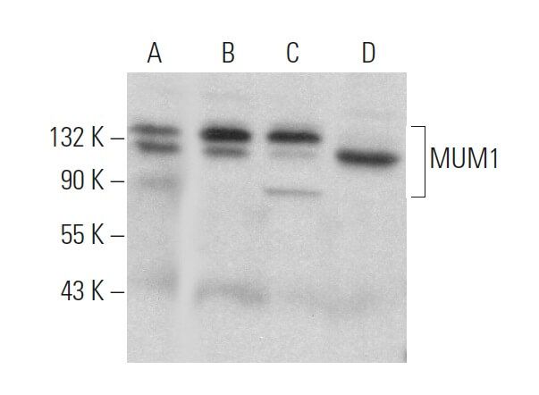 MUM1 Antibody (D-11) | SCBT - Santa Cruz Biotechnology