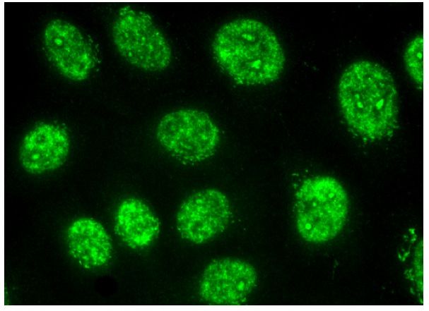 MuRF1 Antibody (C-11) | SCBT - Santa Cruz Biotechnology