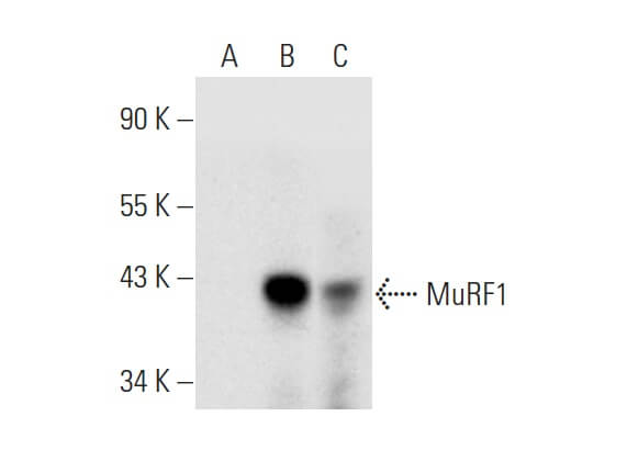 Anti-MuRF1 Antibody (D-5) | SCBT - Santa Cruz Biotechnology