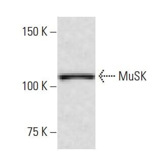 MuSK Antibody (1-YD2) | SCBT - Santa Cruz Biotechnology