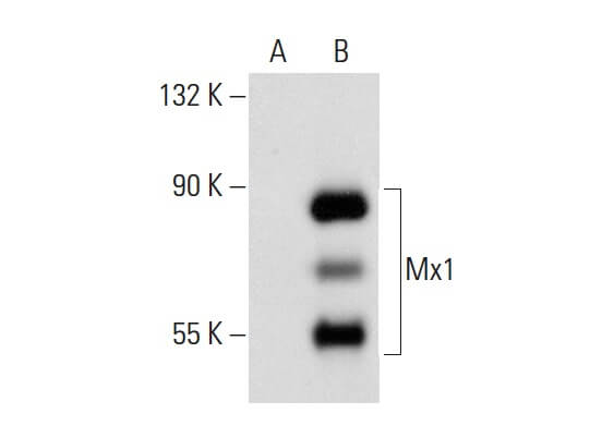 Anti-Mx1 Antibody (E-5) | SCBT - Santa Cruz Biotechnology