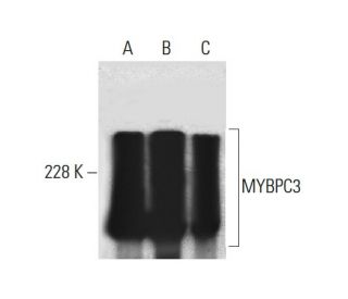 MYBPC3 Antibody (E-7) - Western Blotting - Image 385742