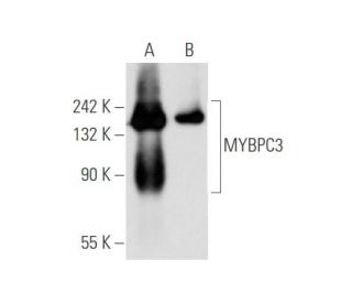 Anti-MYBPC3 Antibody (G-1) | SCBT - Santa Cruz Biotechnology