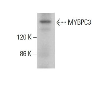 Anti-MYBPC3 Antibody (G-1) | SCBT - Santa Cruz Biotechnology
