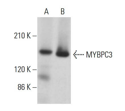 Anti-MYBPC3 Antibody (G-1) | SCBT - Santa Cruz Biotechnology