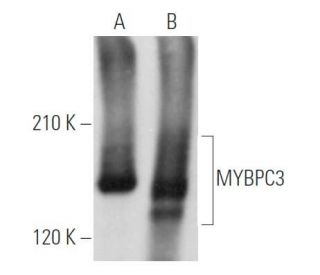 MYBPC3 Antibody (G-2) | SCBT - Santa Cruz Biotechnology