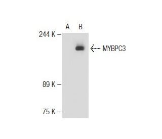 MYBPC3 Antibody (G-7) - Western Blotting - Image 125591