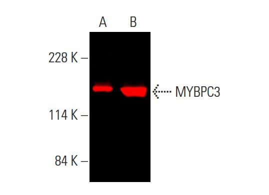 MYBPC3 Antibody (G-7) | SCBT - Santa Cruz Biotechnology