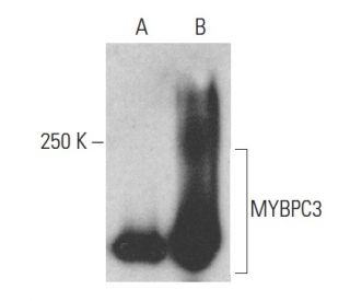 MYBPC3 Antibody (G-7) | SCBT - Santa Cruz Biotechnology
