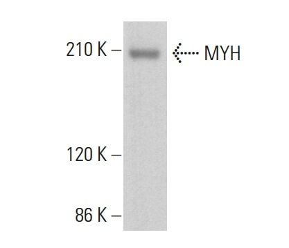 Anti-MYH Antibody (B-5) | SCBT - Santa Cruz Biotechnology
