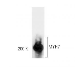 MYH7 Antibody (A4.951) - Western Blotting - Image 14141