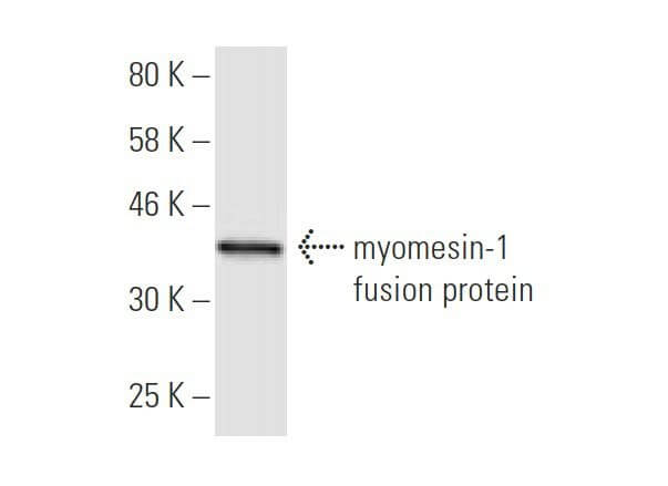 myomesin-1 Antibody (4F5) | SCBT - Santa Cruz Biotechnology