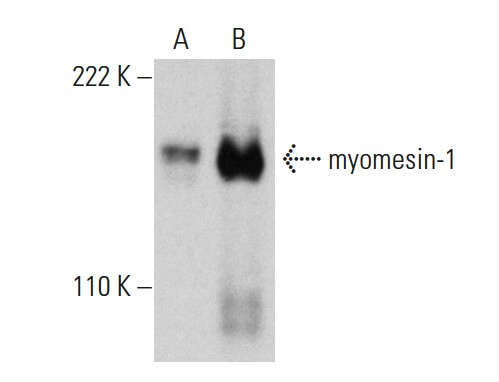 Anti-myomesin-1 Antibody (4F5) | SCBT - Santa Cruz Biotechnology