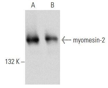 myomesin-2抗体 (E-5) | SCBT - Santa Cruz Biotechnology