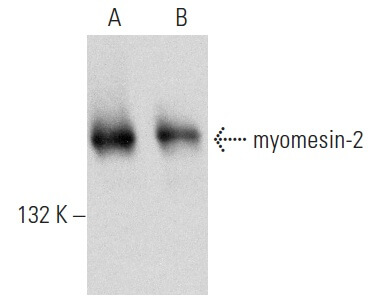 Anti-myomesin-2 Antibody (E-5) | SCBT - Santa Cruz Biotechnology
