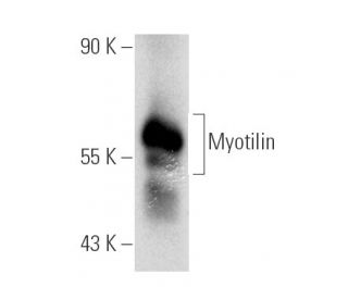 Myotilin Antibody (B-3) | SCBT - Santa Cruz Biotechnology