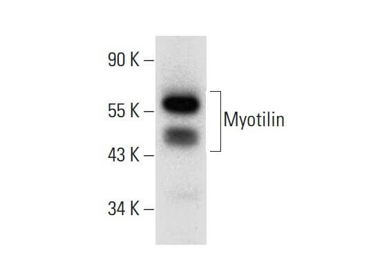 Myotilin Antibody (E-10) | SCBT - Santa Cruz Biotechnology
