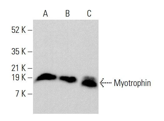 Myotrophin Antibody (D-3) | SCBT - Santa Cruz Biotechnology