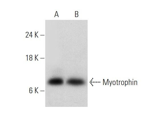 Myotrophin Antibody (E-2) | SCBT - Santa Cruz Biotechnology