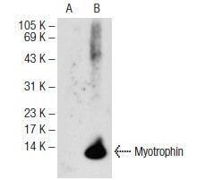 Myotrophin Antibody (F-10) | SCBT - Santa Cruz Biotechnology