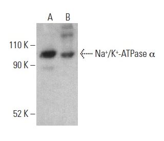 ATP1A1/ATP1A2/ATP1A3 Antibody (H-3) - Western Blotting - Image 400668