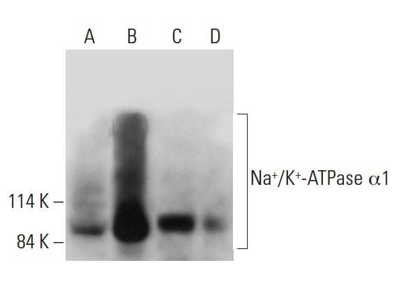 alpha 1 Sodium Potassium ATPase/ATP1A1抗体 (C-5) | SCBT - Santa Cruz ...