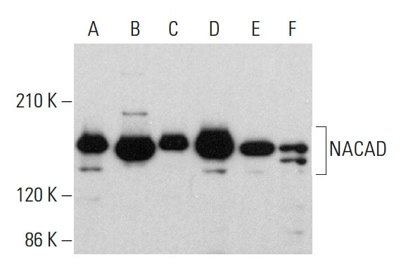 NACAD Antibody (H-4) | SCBT - Santa Cruz Biotechnology