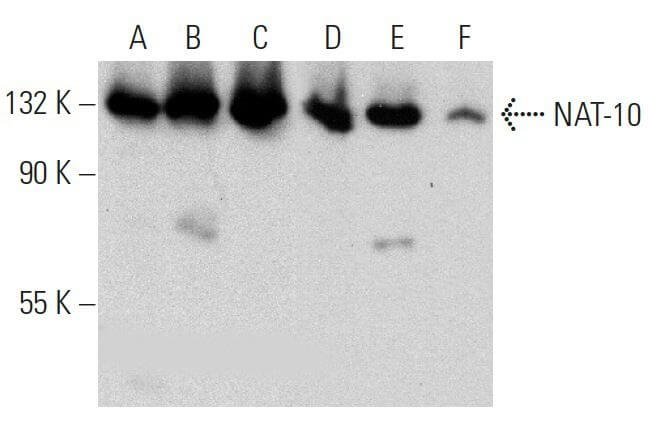 NAT-10 Antibody (D-11) | SCBT - Santa Cruz Biotechnology